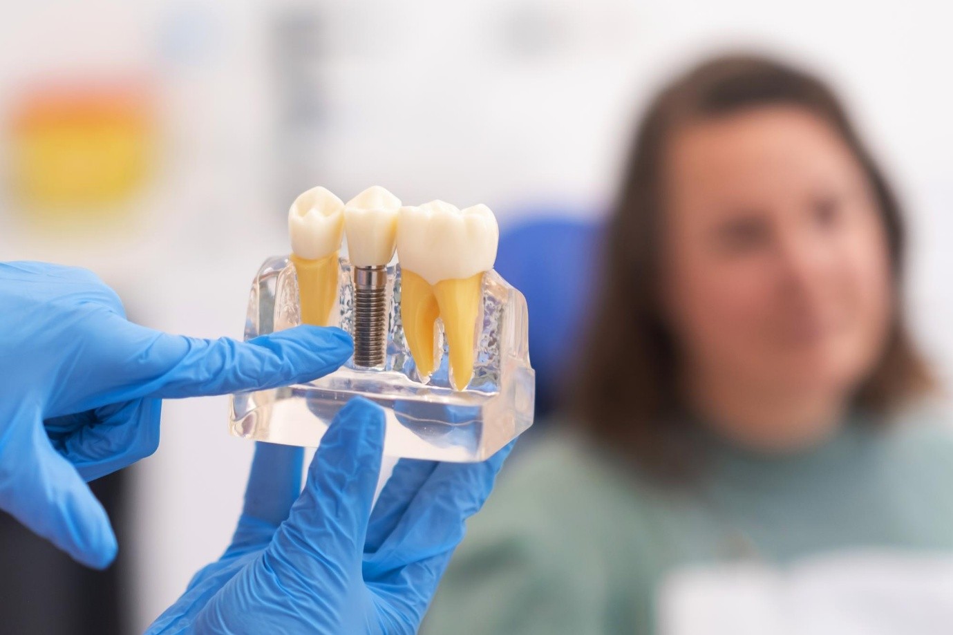 From Gaps to Glow: All-on-4 Transforms Your Smile